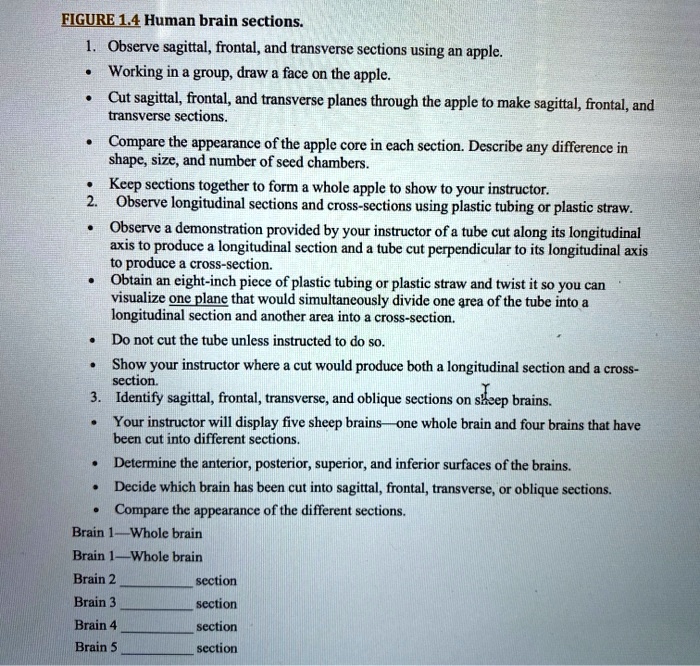 SOLVED: FGUREL 4 Human brain sections: Observe sagittal, frontal, and ...