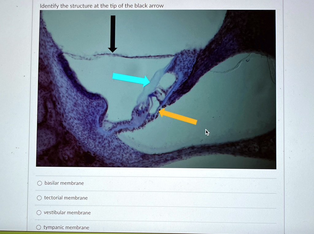 Identify the structure at the tip of the black arrow basilar...