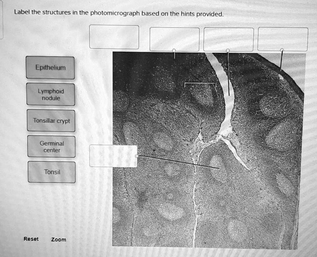 Label the structures in the photomicrograph based on the hints provided ...