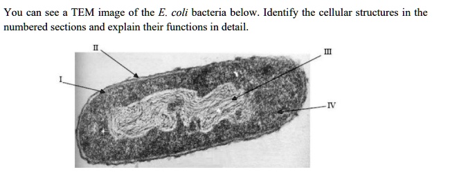 SOLVED: You can see TEM image of the E: coli bacteria below. Identify ...