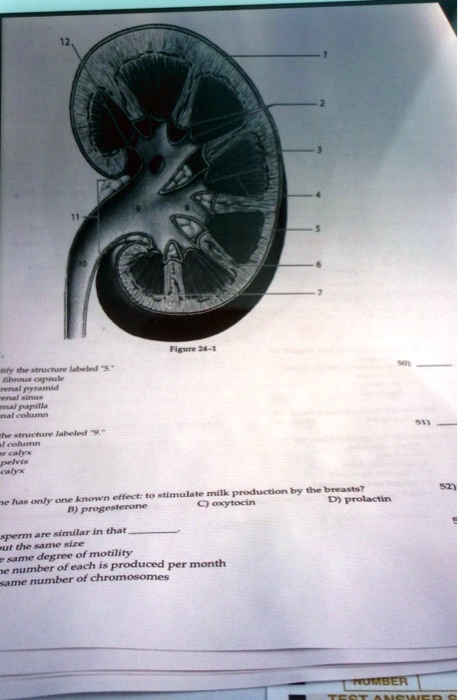 SOLVED: Figure 24 - Identify the structure labeled fibrous capsule ...