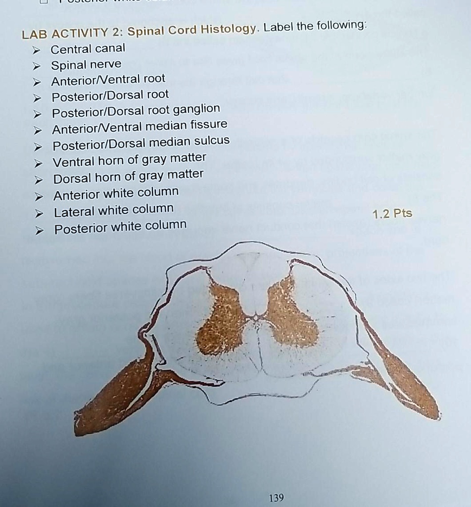 LAB ACTIVITY 2: Spinal Cord Histology. Label the following: ? Central ...