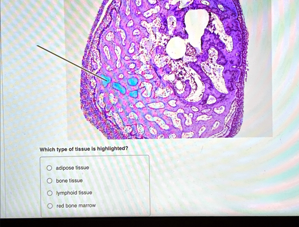 Which type of tissue is highlighted? - adipose tissue - bone tissue ...