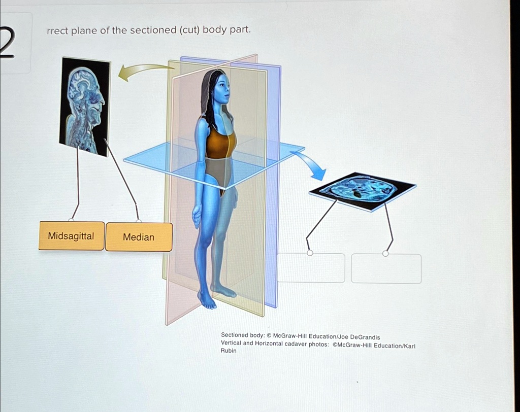 Corrected text: Rect plane of the sectioned (cut) body part. Sectioned ...
