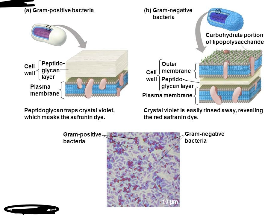 VIDEO solution: (a) Gram-positive bacteria (b) Gram-negative bacteria ...