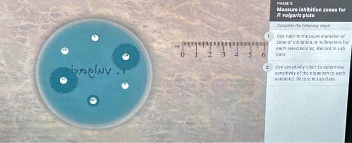 PHASE 3 Measure inhibition zones for P. vulgaris plate Complete the following steps 1 Use ruler ...
