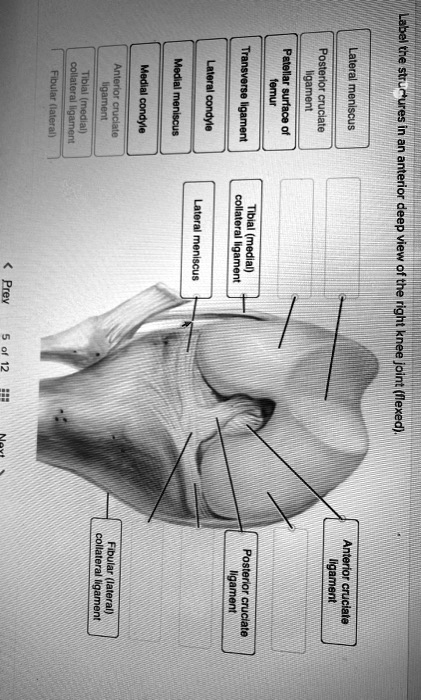 SOLVED: Fibular (lateral) Tibial (medial) Anterior cruciate Medial ...