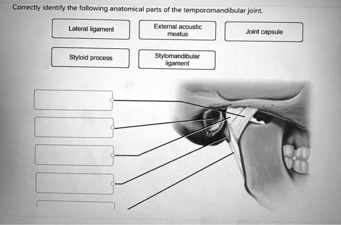 SOLVED: Correctly identify the following anatomical parts of the ...