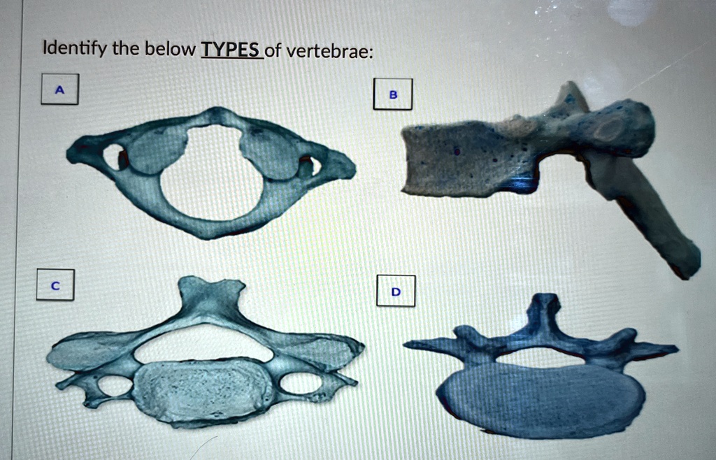 Identify the below TYPES of vertebrae: