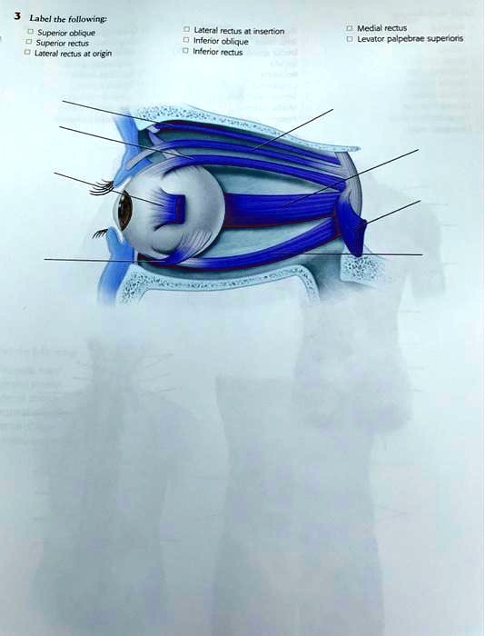 SOLVED: Superior oblique Superior rectus Lateral rectus at origin ...