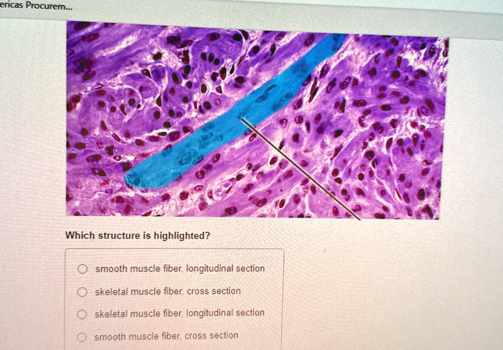 ericas procurem which structure is highlighted smooth muscle fiber ...