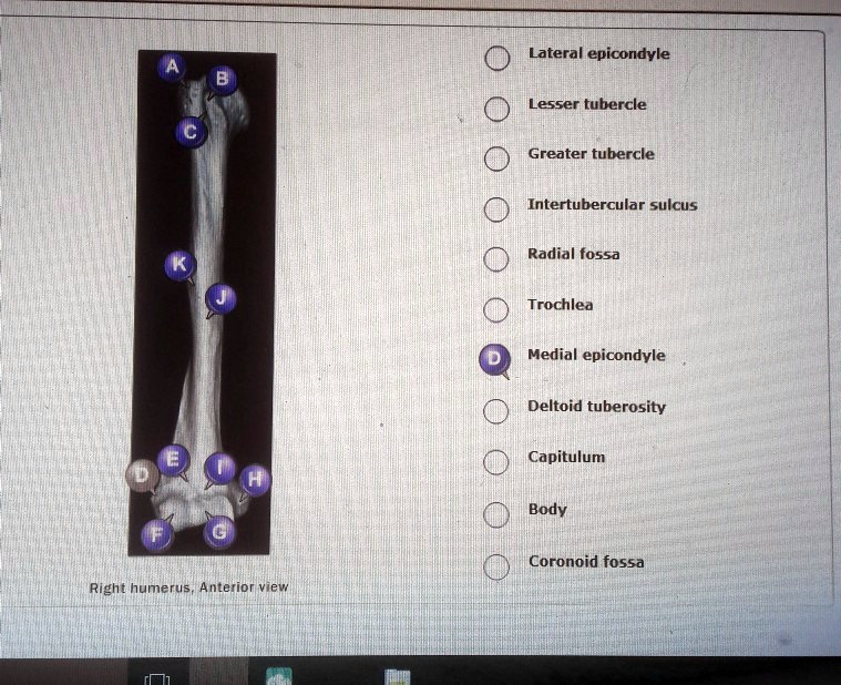 Lateral epicondyle Lesser tubercle Greater tubercle Intertubercular ...