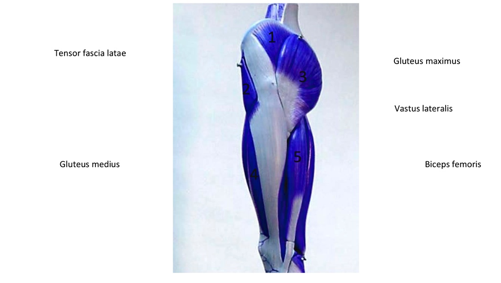 Solved Tensor Fasciae Latae Gluteus Maximus Vastus Lateralis Gluteus
