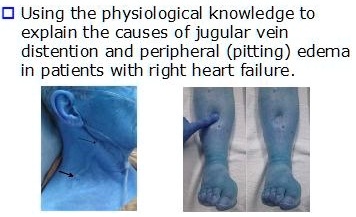 SOLVED: Using physiological knowledge to explain the causes of jugular ...