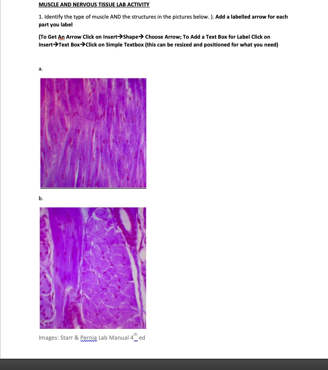MUSCLE AND NERVOUS TISSUE LAB ACTIVITY 1. Identify the type of muscle ...