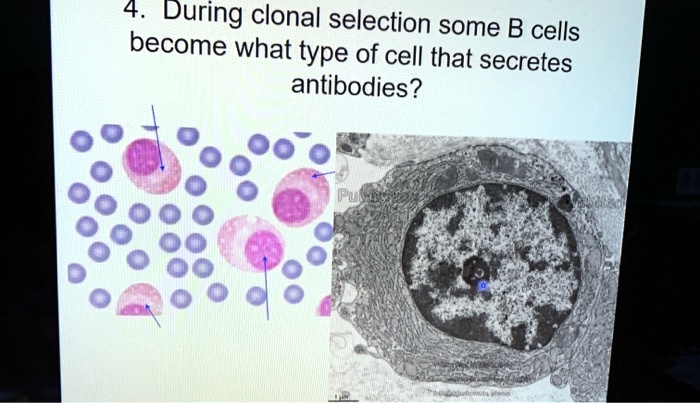 [GET ANSWER] during clonal selection some b cells become what type of ...