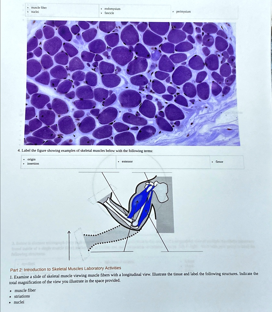 Label the figure showing examples of skeletal muscles below with the ...