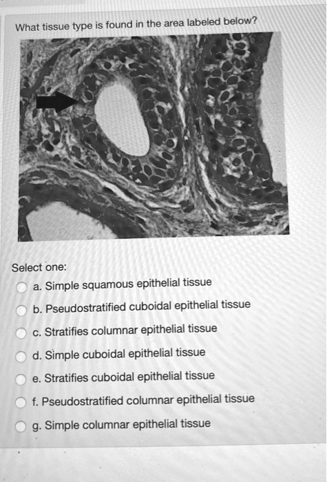 What tissue type is found in the area labeled below? Select one: a ...