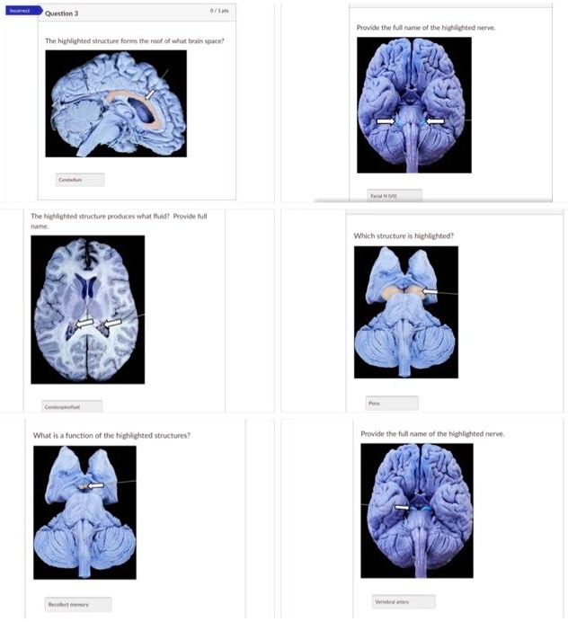 Question 3 0/1 pts Provide the full name of the highlighted nerve. The highlighted structure ...