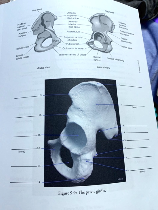 Iliac crest Posterior superior iliac spine Auricular surface Ischial ...