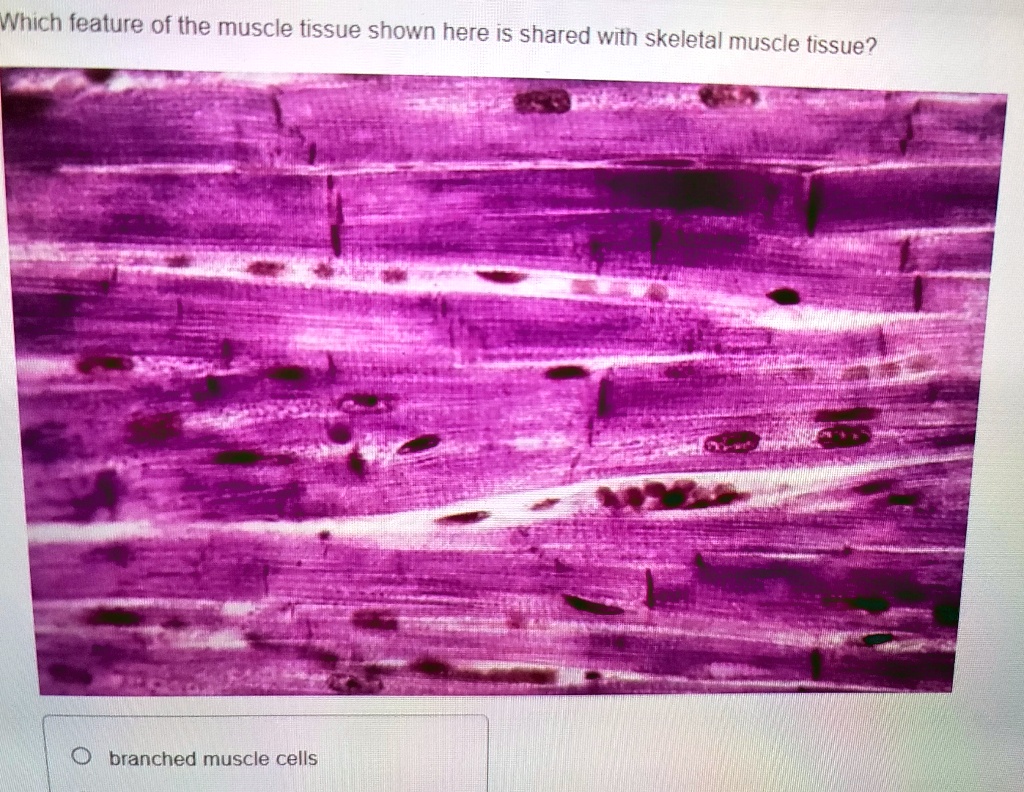 SOLVED: Which feature of the muscle tissue shown here is shared with ...