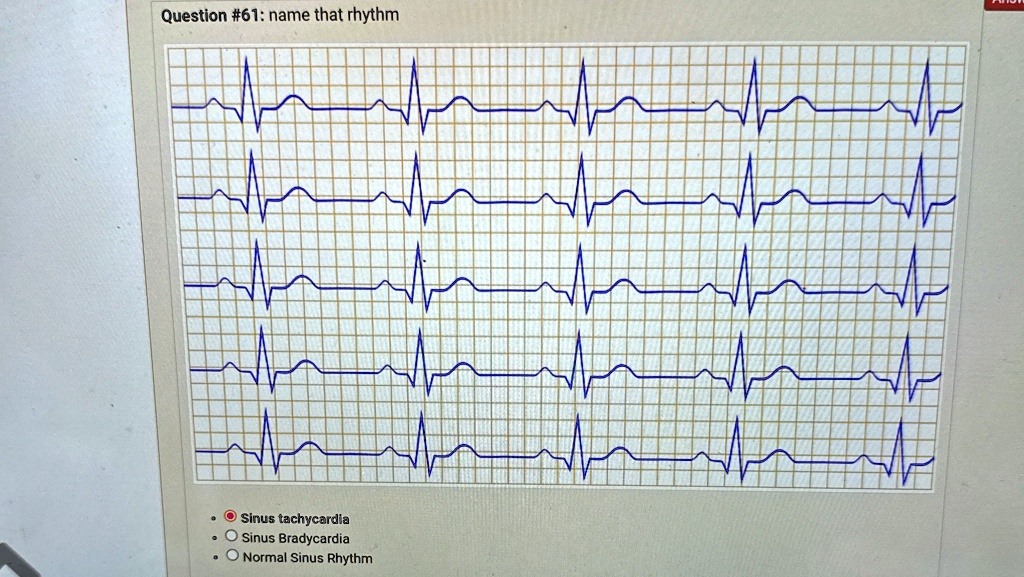 question 61 name that rhythm sinus tachycardia sinus bradycardia normal ...