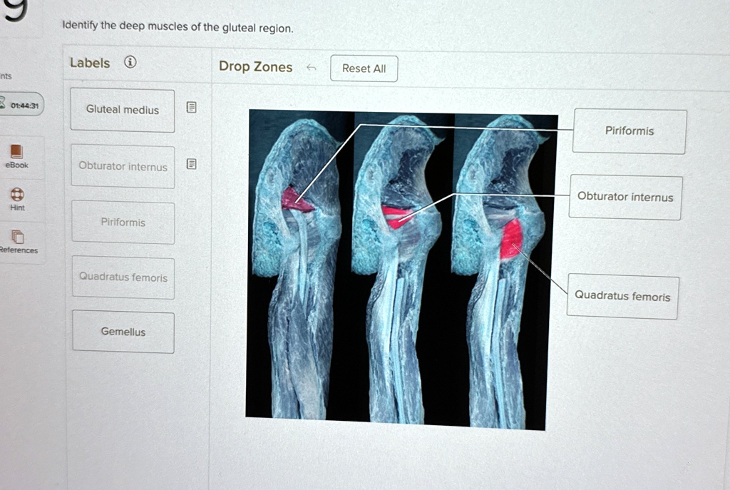 Identify the deep muscles of the gluteal region. Labels Drop Zones ...