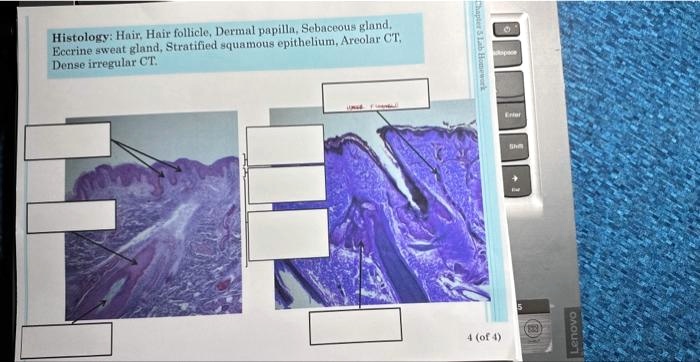 [GET ANSWER] Histology: Hair, Hair follicle, Dermal papilla, Sebaceous ...