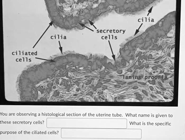 ciliated cells cilia cilia secretory cells lamina propria You are ...