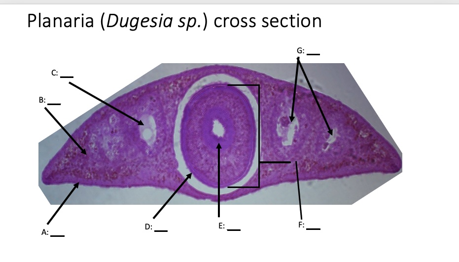 Planaria (Dugesia sp.) Cross Section