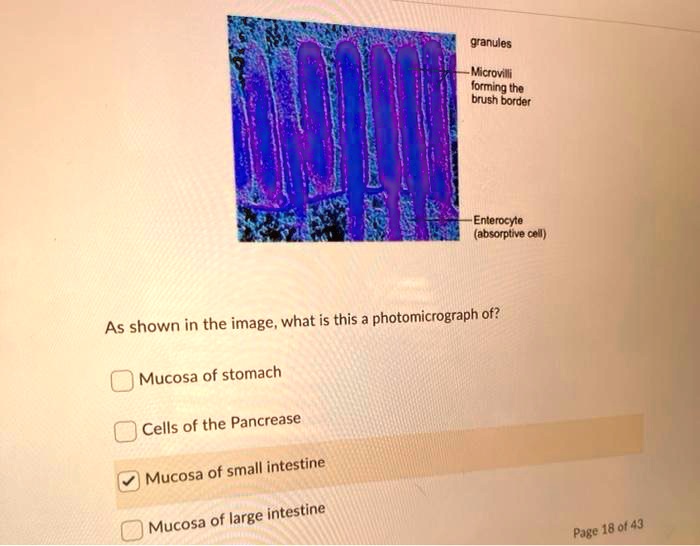 SOLVED: Granules Microvilli forming the brush border Enterocyte ...