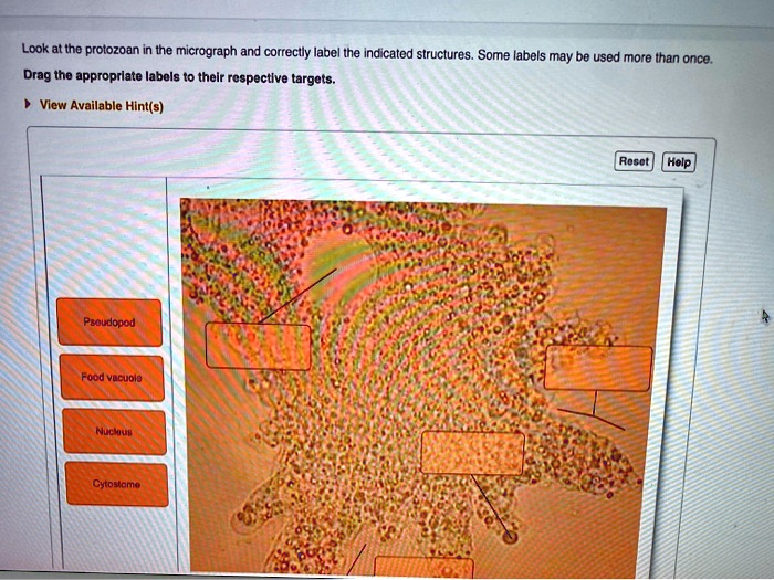 Look at the protozoan in the micrograph and correctly label the ...