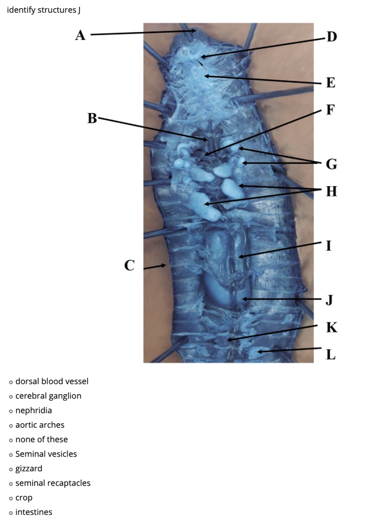 SOLVED: Text: Identify Structures E F B G H K L Dorsal blood vessel ...
