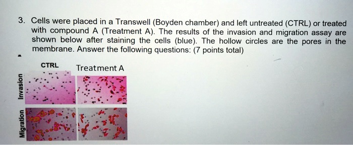 3. Cells were placed in a Transwell (Boyden chamber) and left untreated ...