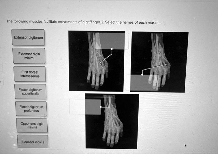 The following muscles facilitate movements of digit/finger 2. Select ...
