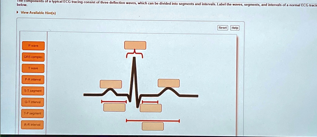 components of a typical ecg tracing consist of three deflection waves ...