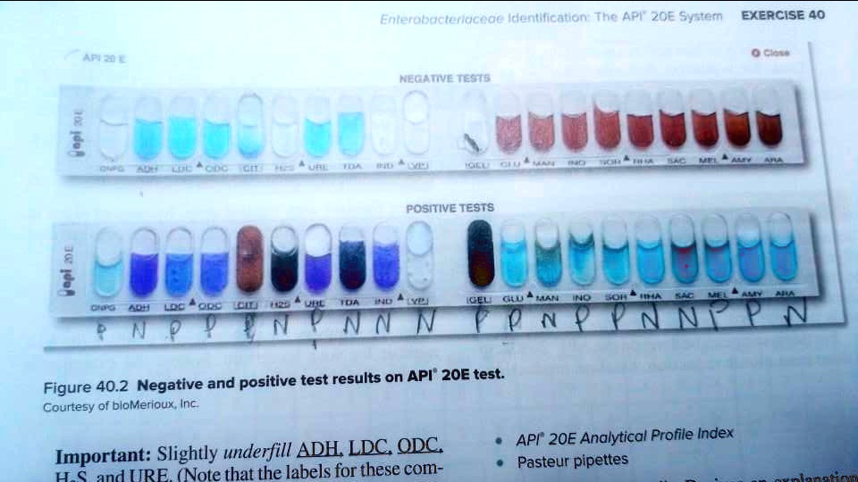 SOLVED:Enterobactericiceae Idenlilication The Api' ZOE Syslem ExeRciSE ...