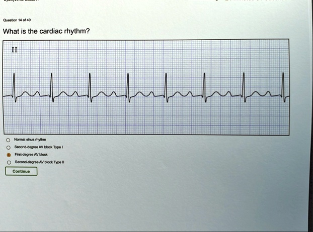 question 14 of 40 what is the cardiac rhythm ii normal sinus rhythm ...