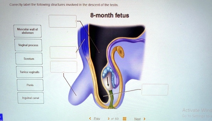 Correctly label the following structures involved in the descent of the ...
