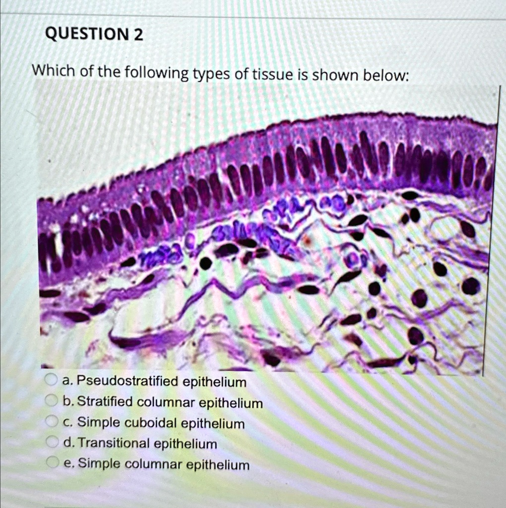 SOLVED: QUESTION 2 Which of the following types of tissue is shown ...