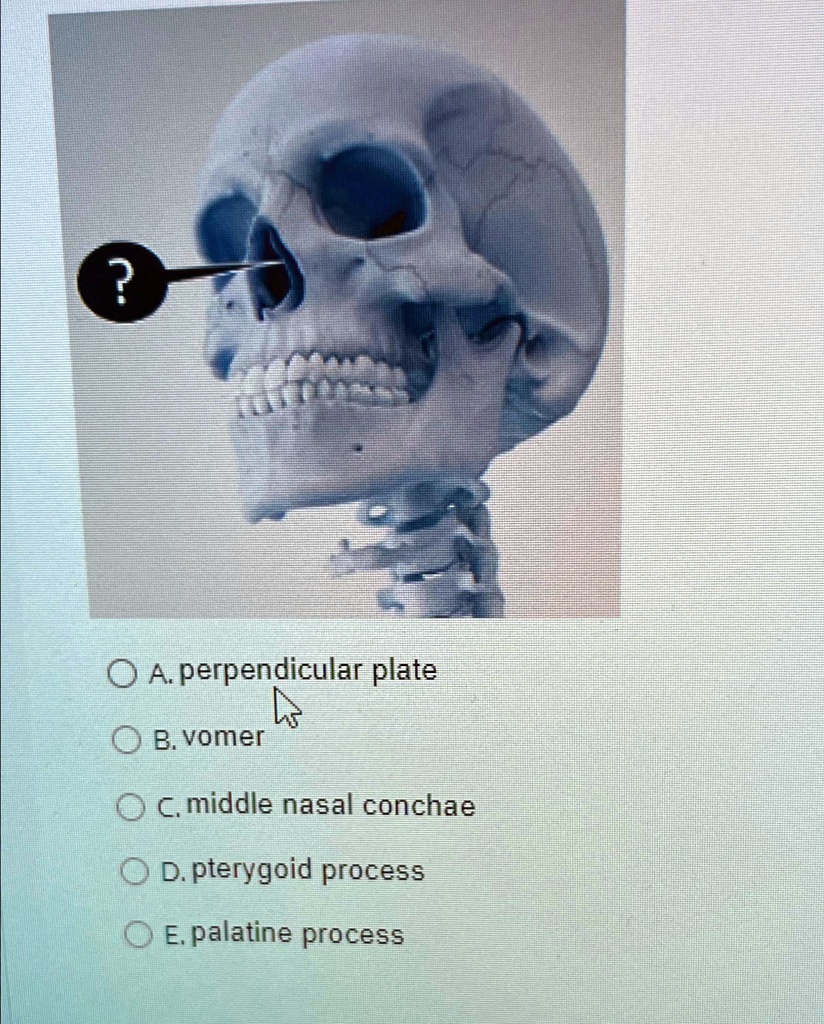 SOLVED: A. perpendicular plate B. vomer C. middle nasal conchae D ...