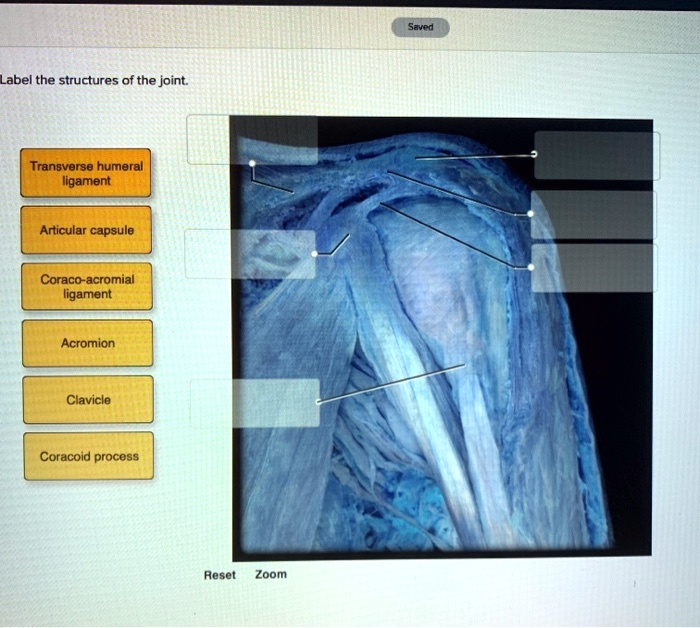 Label the structures of the joint. Transverse humeral ligament ...