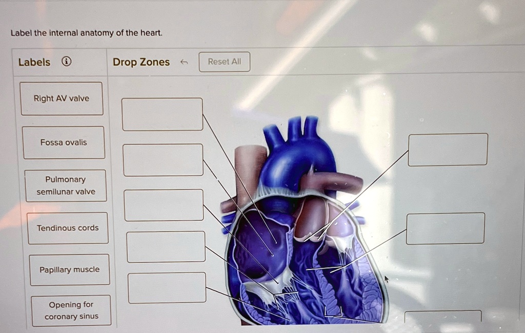 Label the internal anatomy of the heart. Labels Right AV valve Fossa ...