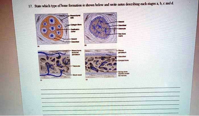 17. State which type of bone formation is shown below and write notes ...
