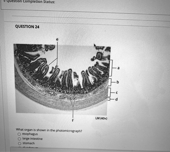 SOLVED: QUESTION 24 LM(40) What organ is shown in the photomicrograph ... SOLVED: QUESTION 24 LM(40) What organ is shown in the photomicrograph ...