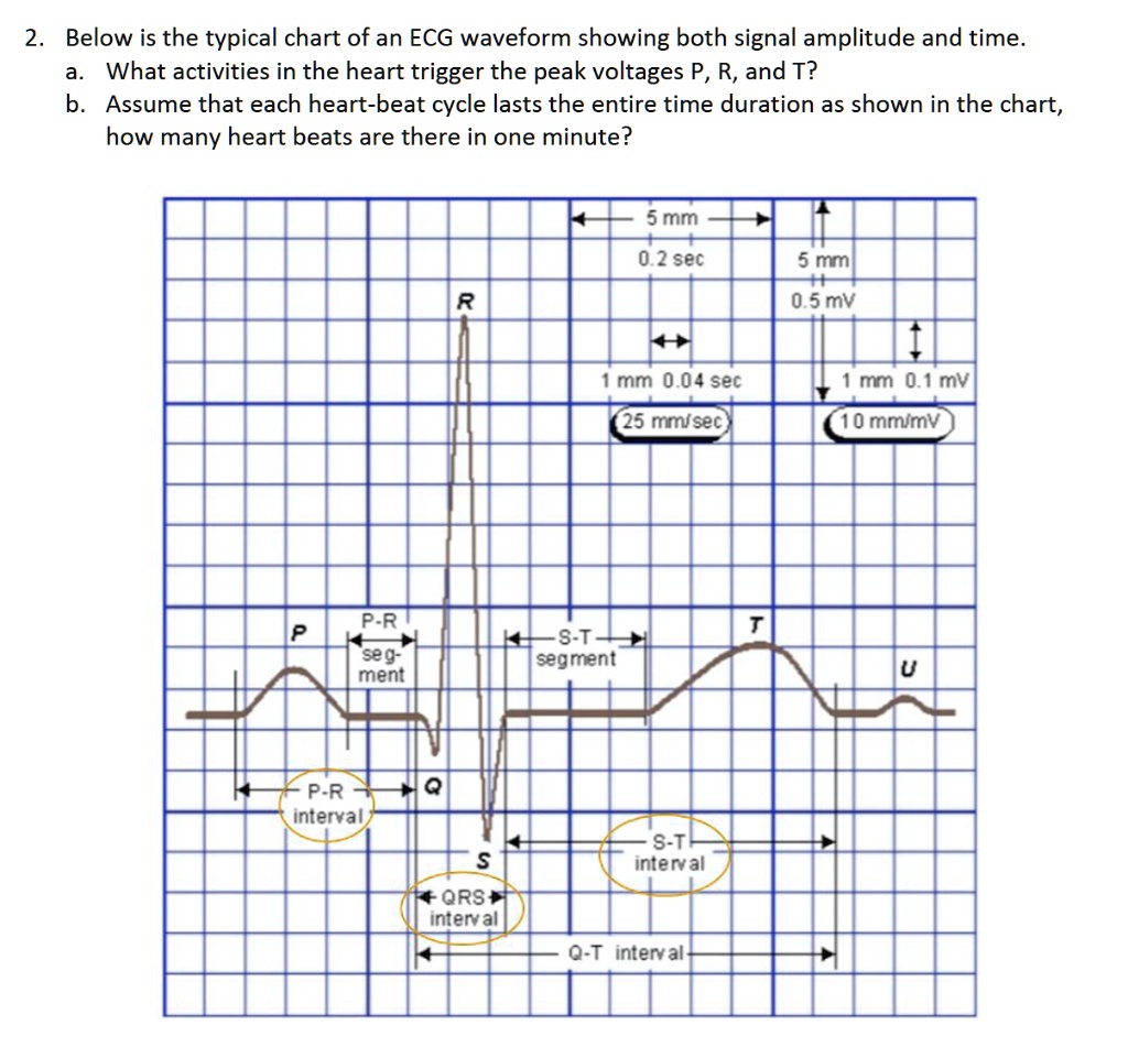 2. Below is the typical chart of an ECG waveform showing...