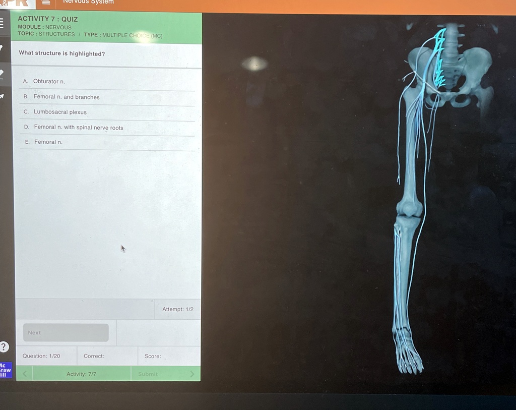 activity 7 quiz module nervous system topic structures type multiple choice mc what structure is ...