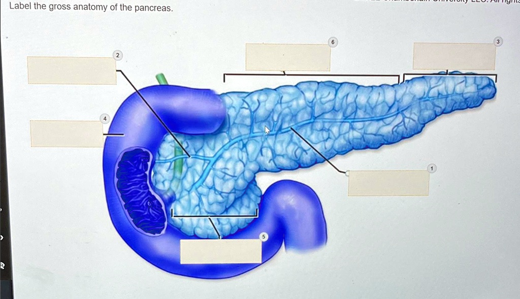 SOLVED: Label the gross anatomy of the pancreas. Label the gross ...