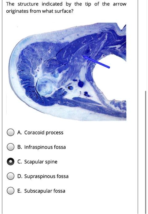 the structure indicated by the tip of the arrow originates from what ...