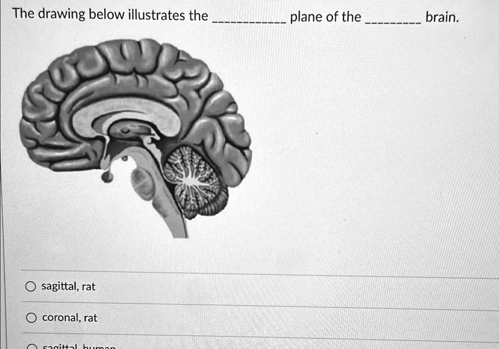 The drawing below illustrates the plane of the brain. ? sagittal, rat ...